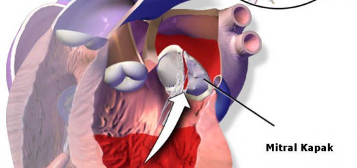 Mitral Kapak Nasıl Anlaşılır? | E2 Sağlık